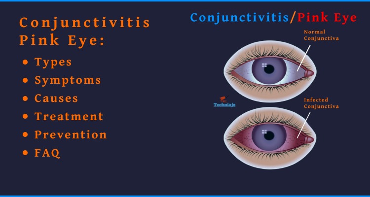 Conjunctivitis or Pink Eye: Symptoms, Causes, & Prevention