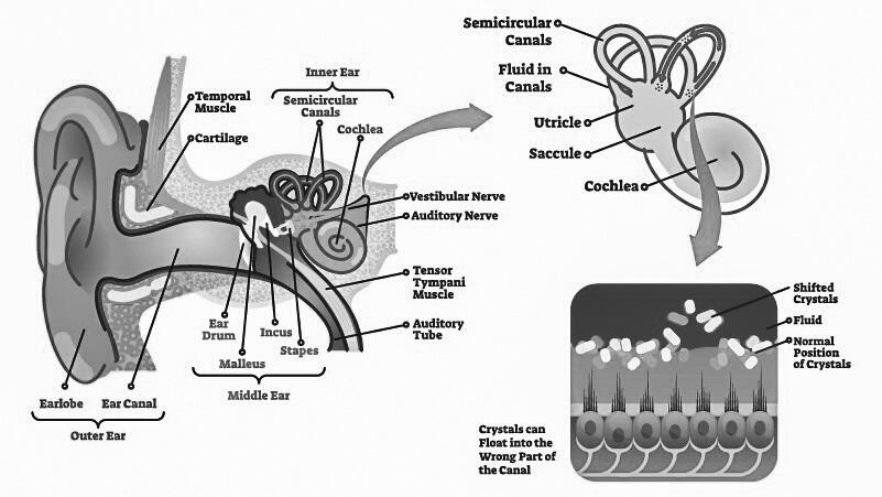 Vertigo: Types, Causes, Symptoms, Diagnosis, Treatment & FAQ